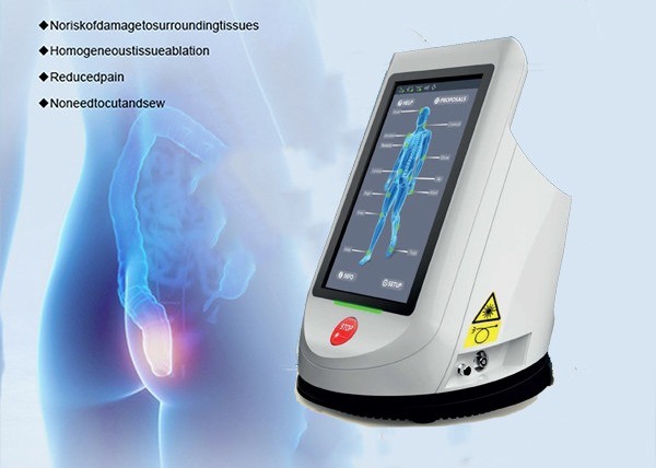 Advanced 980nm Laser Treatment For Piles Or Hemorrhoids Fistula ...